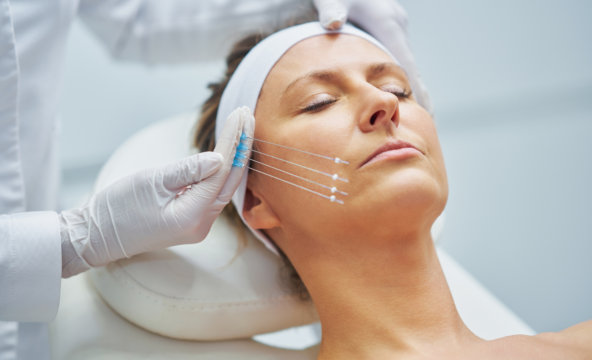 THREAD-LIFT NON-SURGICAL FACE LIFT - London Aesthetics & Rejuvenation ...